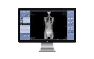 XRAY SOLUTIONS | High Quality X-Ray Equipment