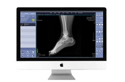 Lowest Price Podiatry X-Ray Equipment – We Buy and Sell New & Used ...